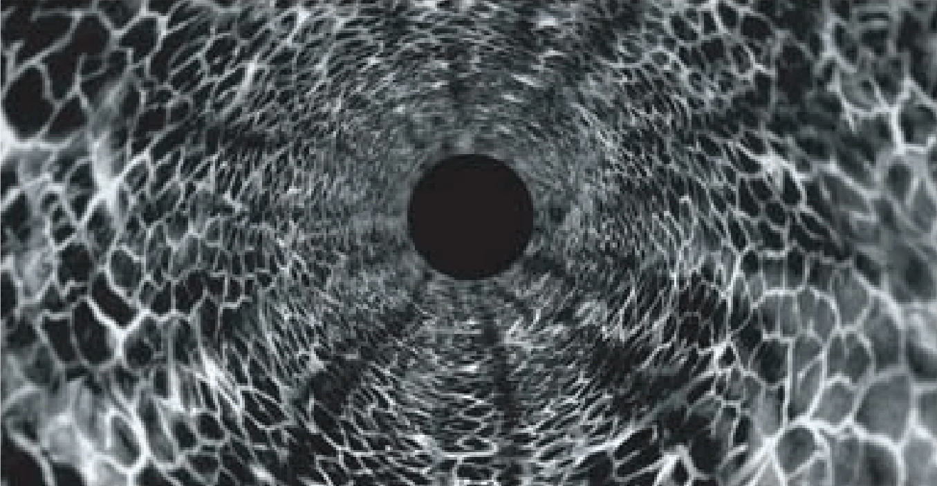 What Are Some Game-Changing Advancements in Lens Technology ...